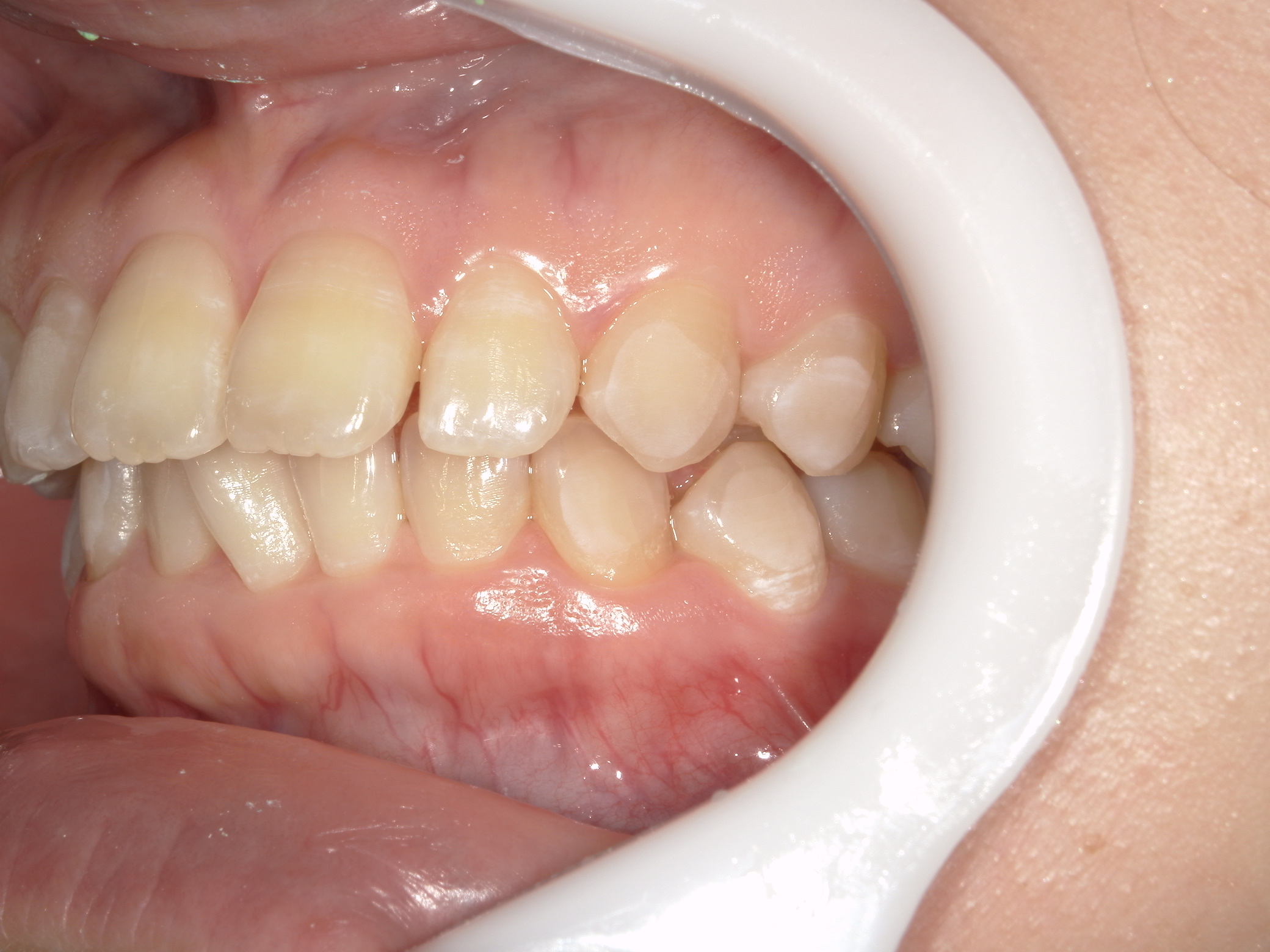 SHOFU DENTAL DIGITAL CAMERA | 福津市 歯医者/歯科｜たくみ歯科・矯正歯科 イオンモール福津